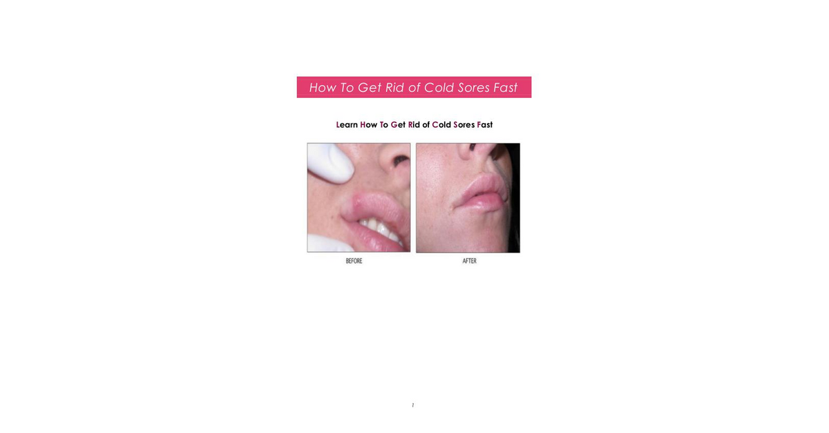 How To Get Rid Of A Cold Sore Naturally how-to-get-rid-of-a-cold-sore-naturally